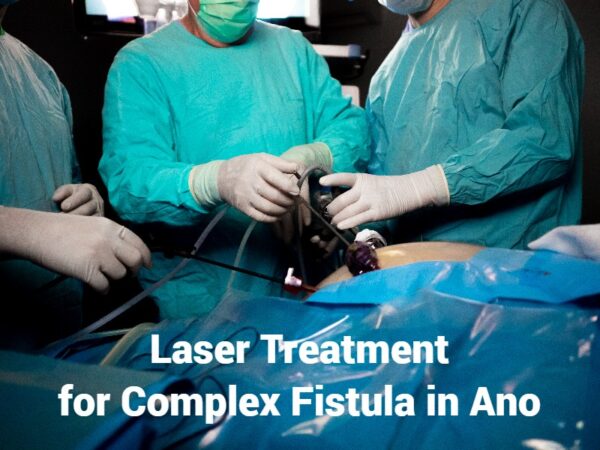 Complex Fistula in Ano- Laser Treatment | Dr.Abhijit Gotkhinde | Ultra ...