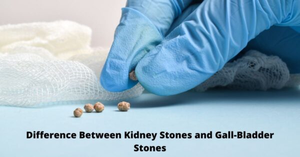 Difference Between Kidney Stones and Gall-Bladder Stones