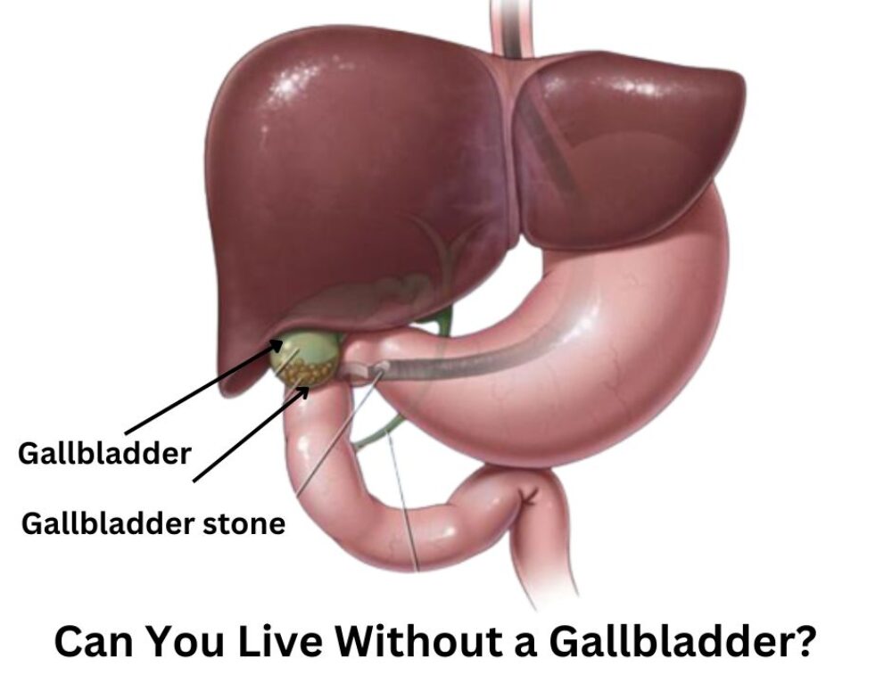 Recognizing the Symptoms of a Gallbladder Attack